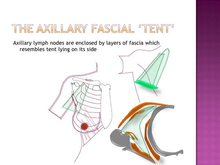 surgical anatomy of breast & management of advanced carcinoma breast