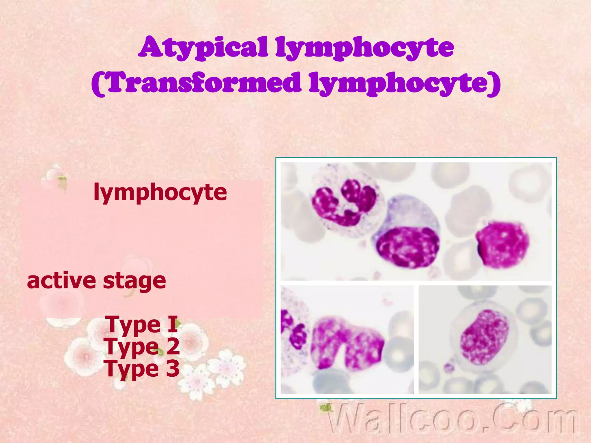C:\Documents And Settings\User\Desktop\Agranulocytic Series+Abnormal Wbc | PPT