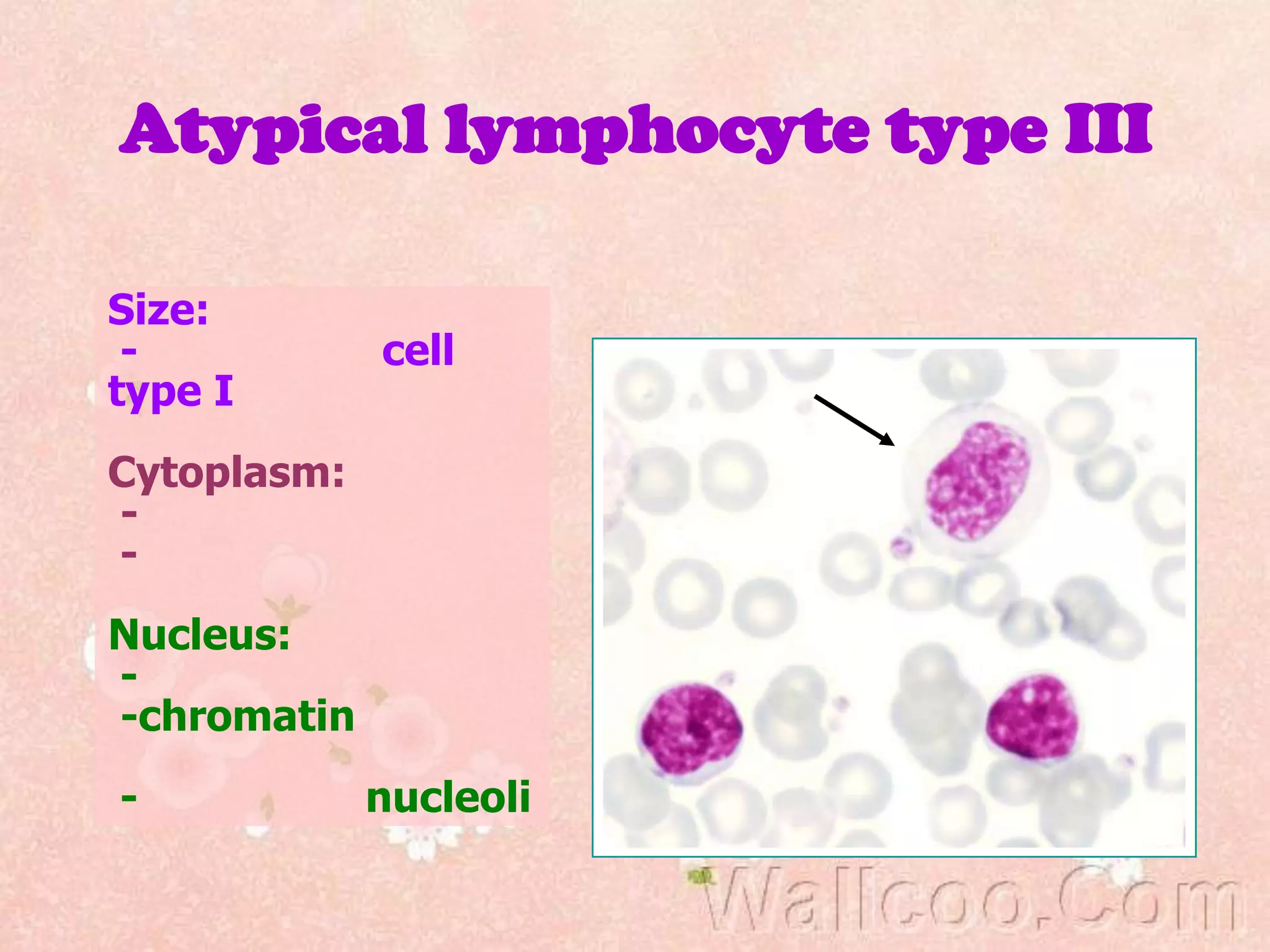 C:\Documents And Settings\User\Desktop\Agranulocytic Series+Abnormal Wbc | PPT