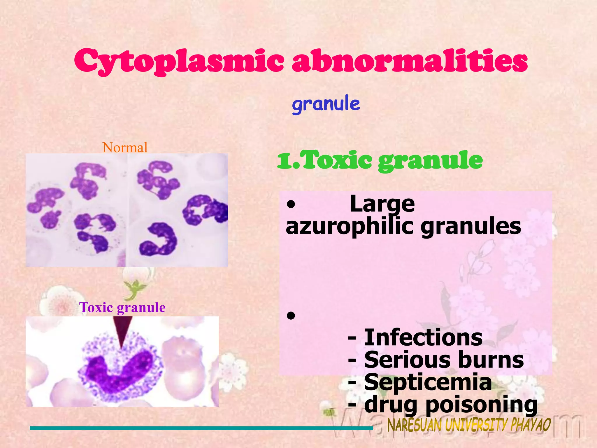 C:\Documents And Settings\User\Desktop\Agranulocytic Series+Abnormal Wbc | PPT
