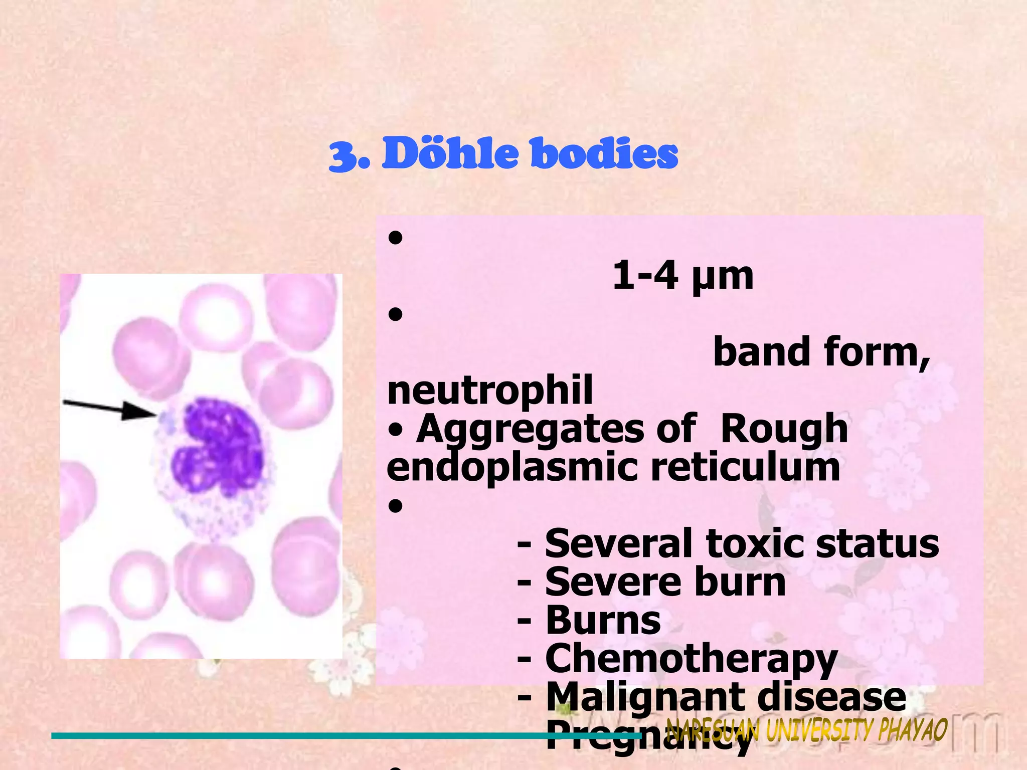 C:\Documents And Settings\User\Desktop\Agranulocytic Series+Abnormal Wbc | PPT