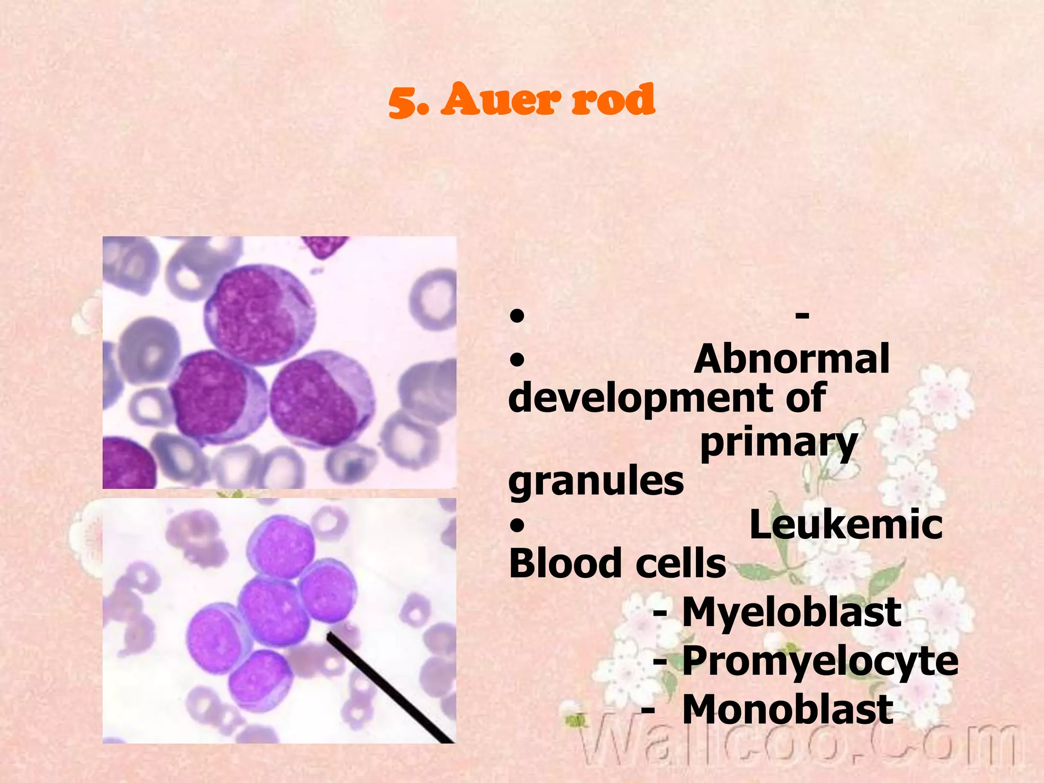 C:\Documents And Settings\User\Desktop\Agranulocytic Series+Abnormal Wbc | PPT
