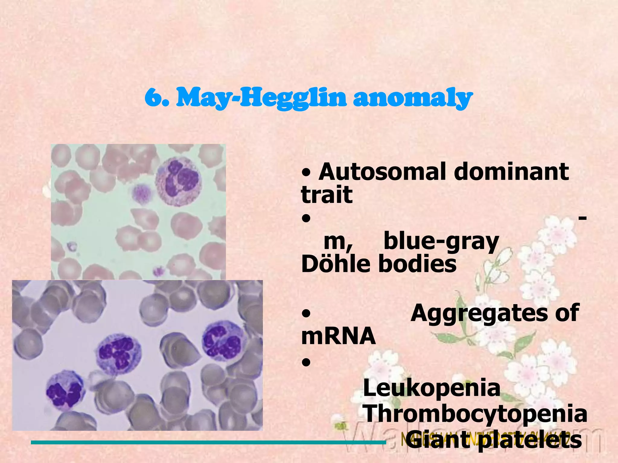 C:\Documents And Settings\User\Desktop\Agranulocytic Series+Abnormal Wbc | PPT