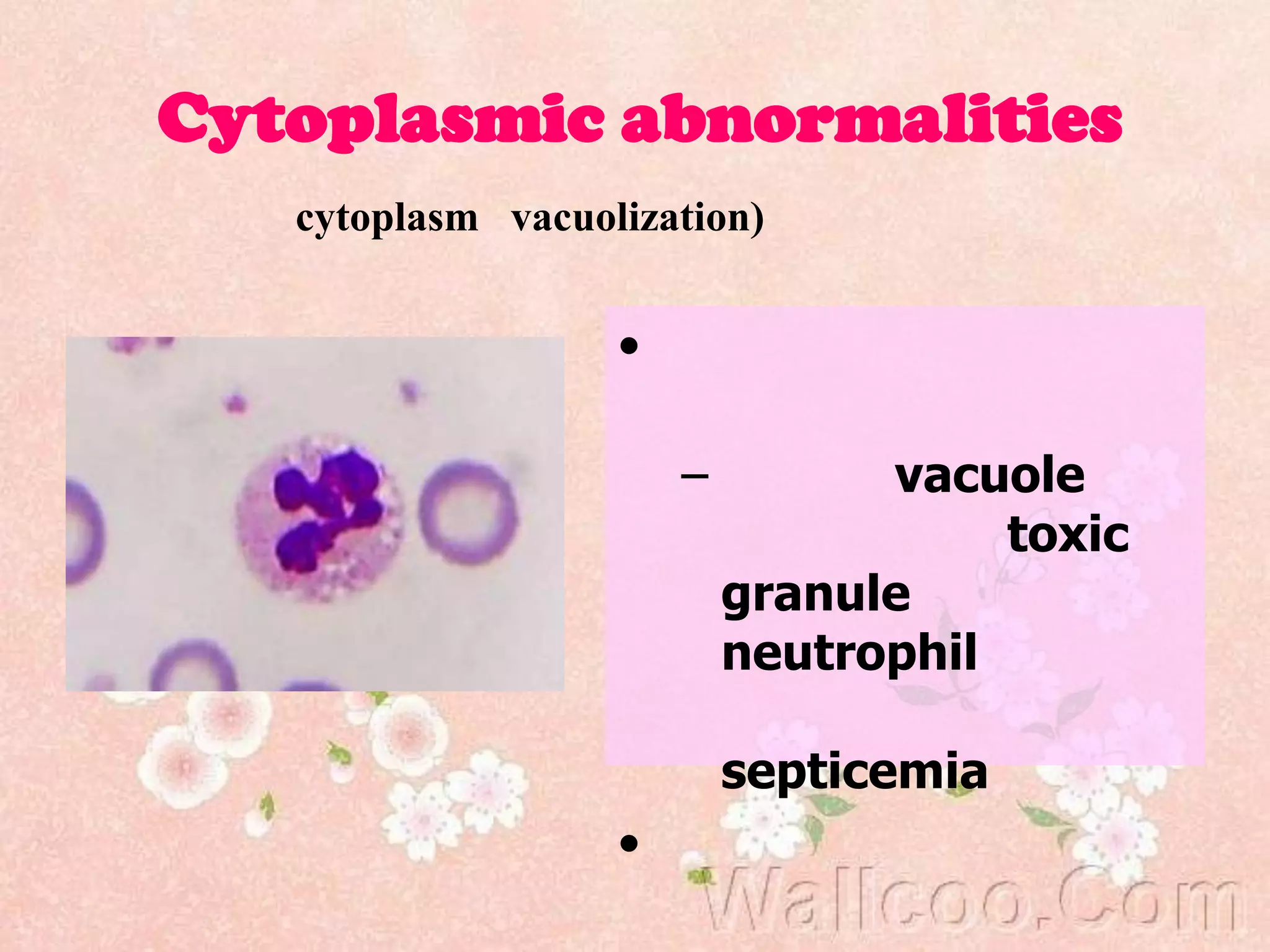 C:\Documents And Settings\User\Desktop\Agranulocytic Series+Abnormal Wbc | PPT