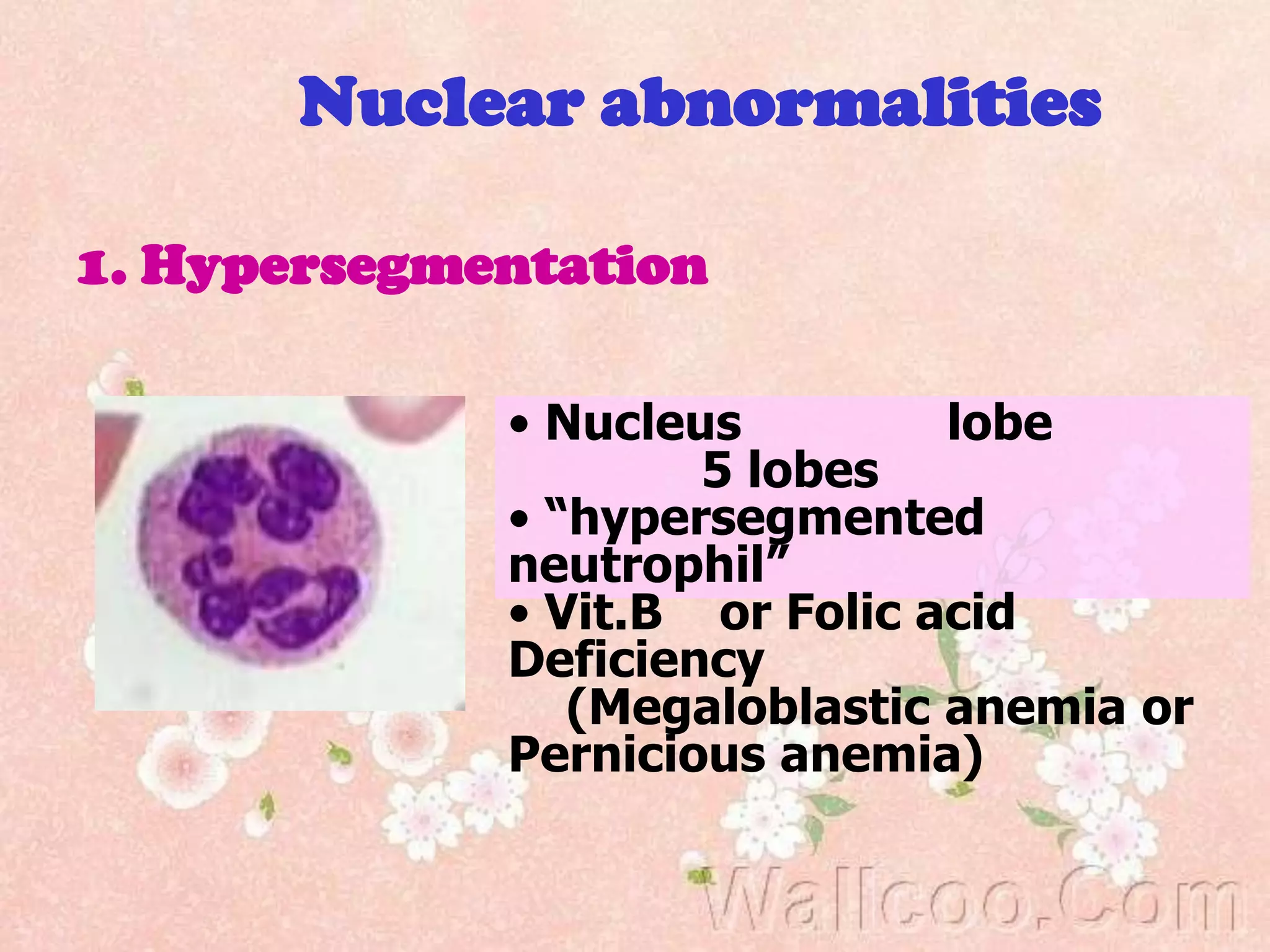 C:\Documents And Settings\User\Desktop\Agranulocytic Series+Abnormal Wbc | PPT
