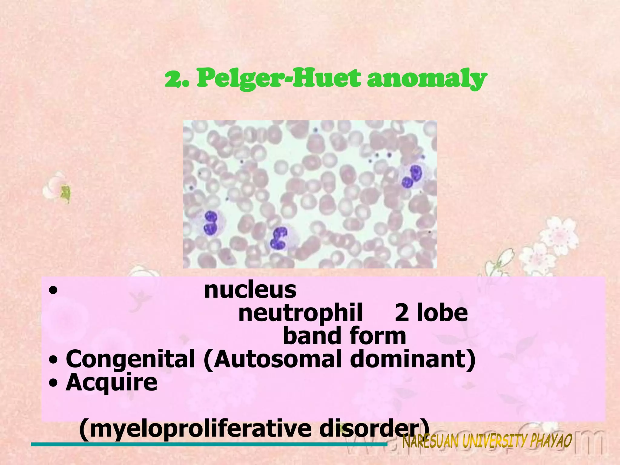 C:\Documents And Settings\User\Desktop\Agranulocytic Series+Abnormal Wbc | PPT