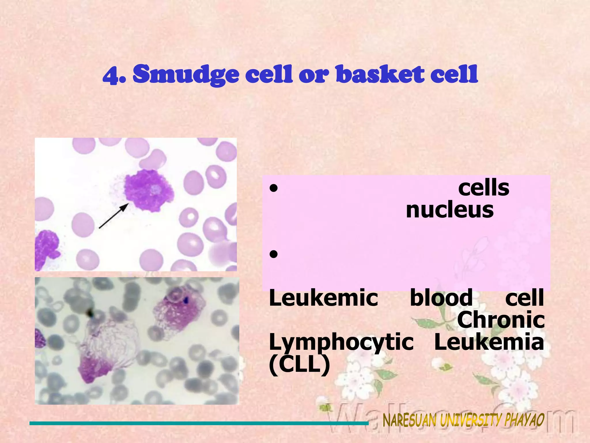 C:\Documents And Settings\User\Desktop\Agranulocytic Series+Abnormal Wbc | PPT