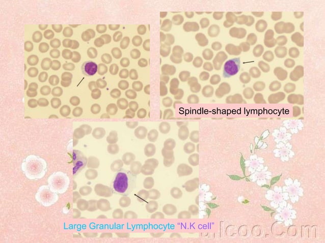 C:\Documents And Settings\User\Desktop\Agranulocytic Series+Abnormal Wbc | PPT