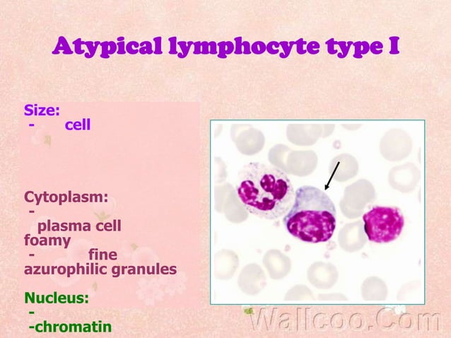 C:\Documents And Settings\User\Desktop\Agranulocytic Series+Abnormal Wbc | PPT