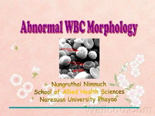 C:\Documents And Settings\User\Desktop\Agranulocytic Series+Abnormal Wbc | PPT