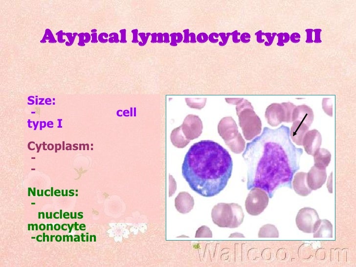 Reactive Lymphocytes Vs Monocytes