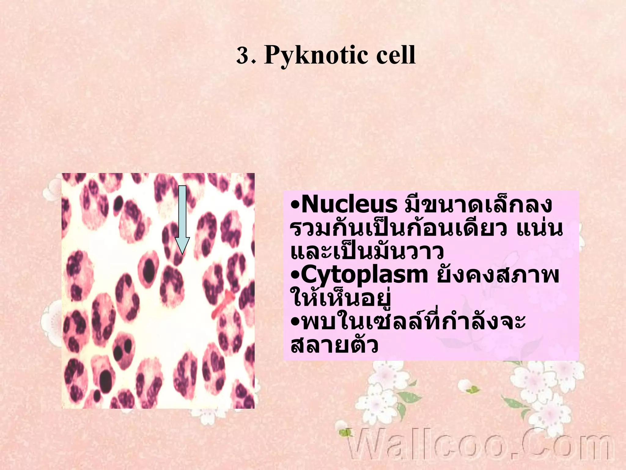 C:\Documents And Settings\User\Desktop\Agranulocytic Series+Abnormal Wbc | PPT