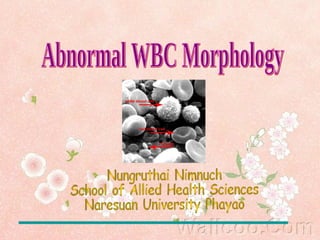 C:\Documents And Settings\User\Desktop\Agranulocytic Series+Abnormal ...