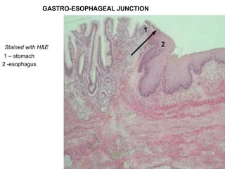 Gastroesophageal Junction Slide Labeled