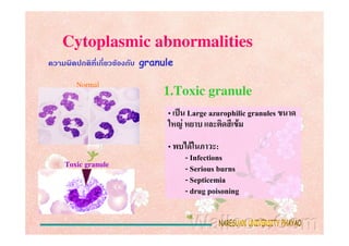 C:\Documents And Settings\User\Desktop\Microsoft Power Point Agranulocytic Series+Abnormal Wbc | PPT