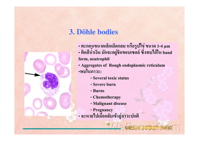 C:\Documents And Settings\User\Desktop\Microsoft Power Point Agranulocytic Series+Abnormal Wbc | PPT