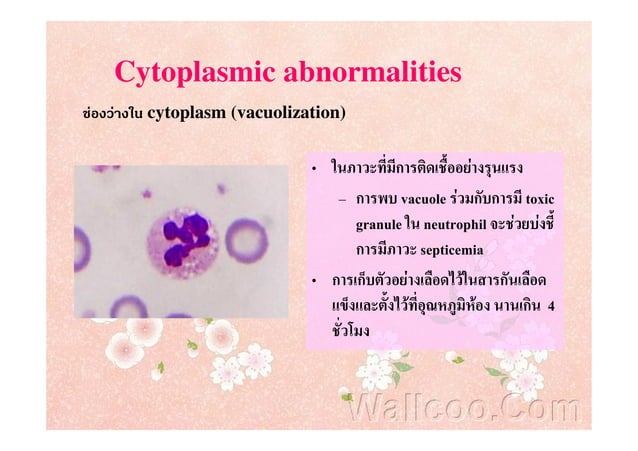 C:\Documents And Settings\User\Desktop\Microsoft Power Point Agranulocytic Series+Abnormal Wbc | PPT