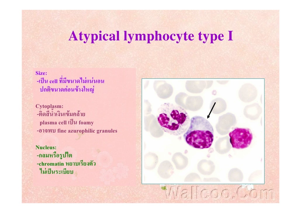 Identification Of Immature Granulocytes In Cancer