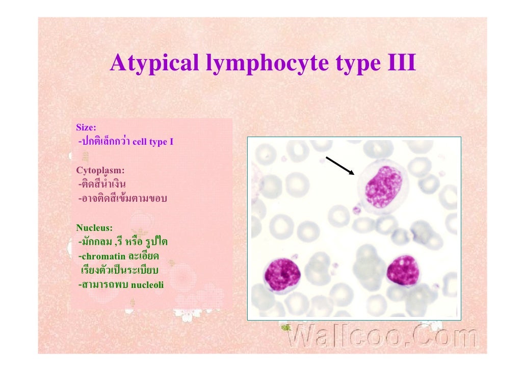 Identification Of Immature Granulocytes In Cancer