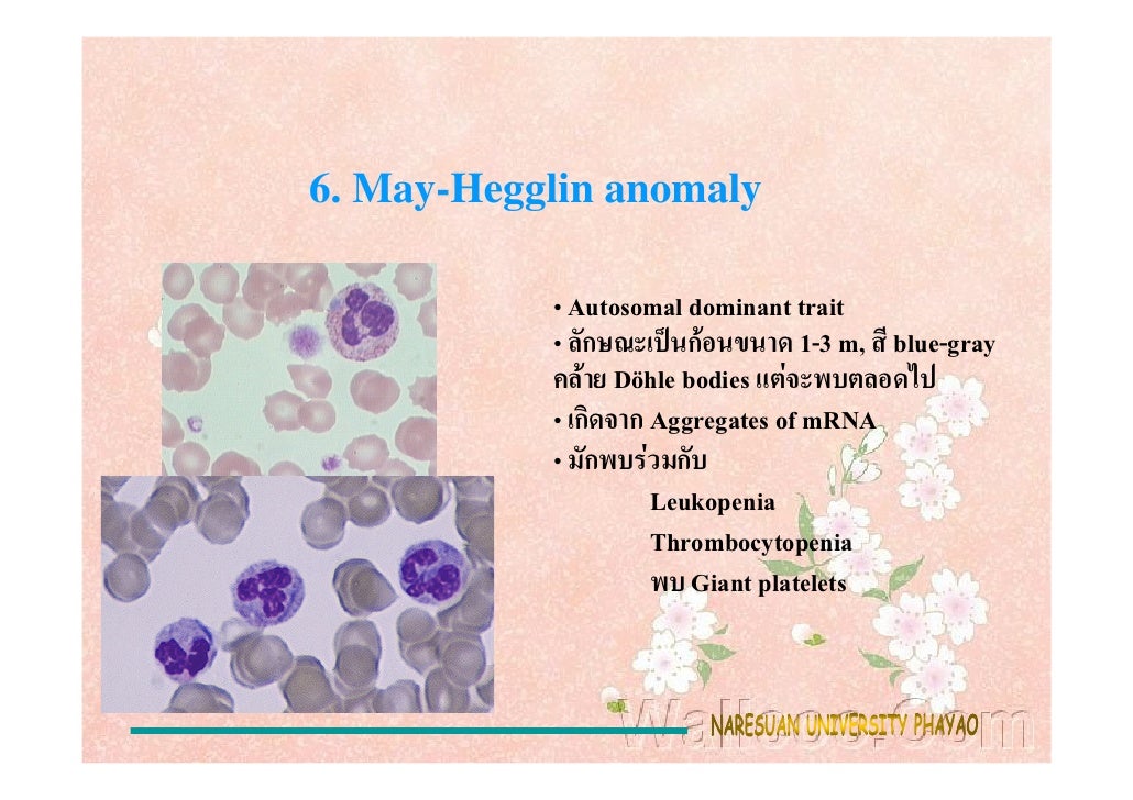 Identification Of Immature Granulocytes In Cancer
