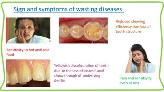 wasting disease flip chart | PPTX