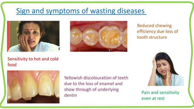 wasting disease flip chart | PPTX