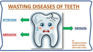 wasting disease flip chart | PPTX