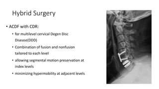 Cervical Disc Replacement in Orthopaedics | PPTX