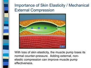 CDT-Edema-Therapy-in-Wound-Care.ppt