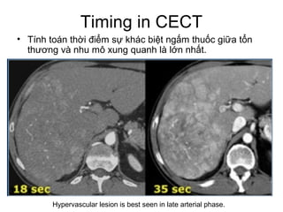 CT contrast injection and protocols (Vietnamese) | PPT