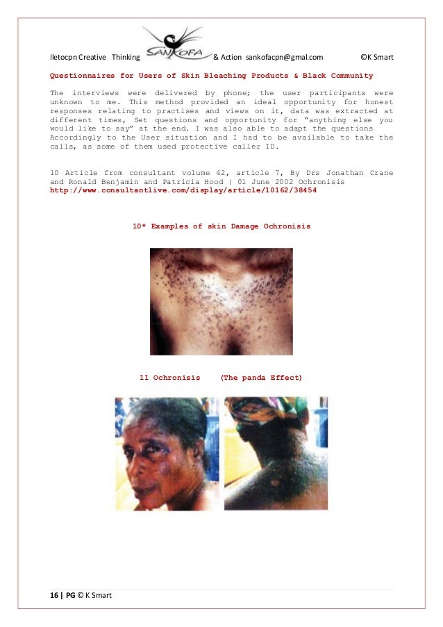 The Causes & Effects of The use of skin Bleaching Products Ce sb-ks-d…