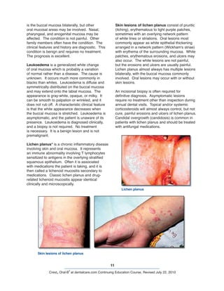 Differential Dignosis of Oral Mucosal lesions | PDF