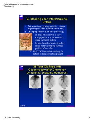 Optimizing Gastrointestinal Bleeding Scintigraphy | PDF