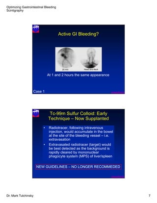 Optimizing Gastrointestinal Bleeding Scintigraphy | PDF | Digestive ...