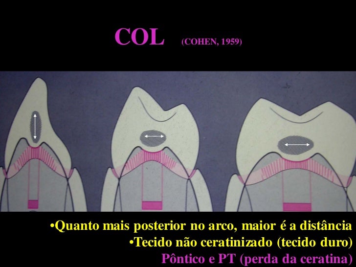 Anatomia e histofisiologia do periodonto