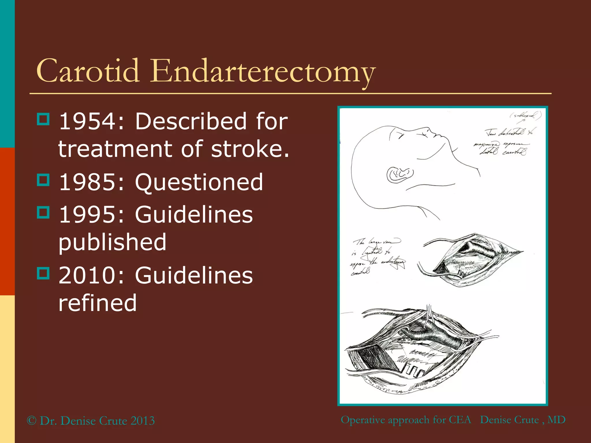 Carotid Endarterectomy in Stroke Prevention Update | PPT