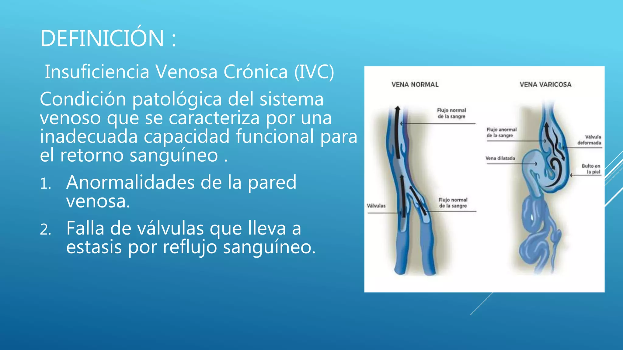 Clasificacion Ceap para varices | PPTX