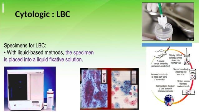 CECAP-JHPIEGO ROCHE 10 february 2025.pptx