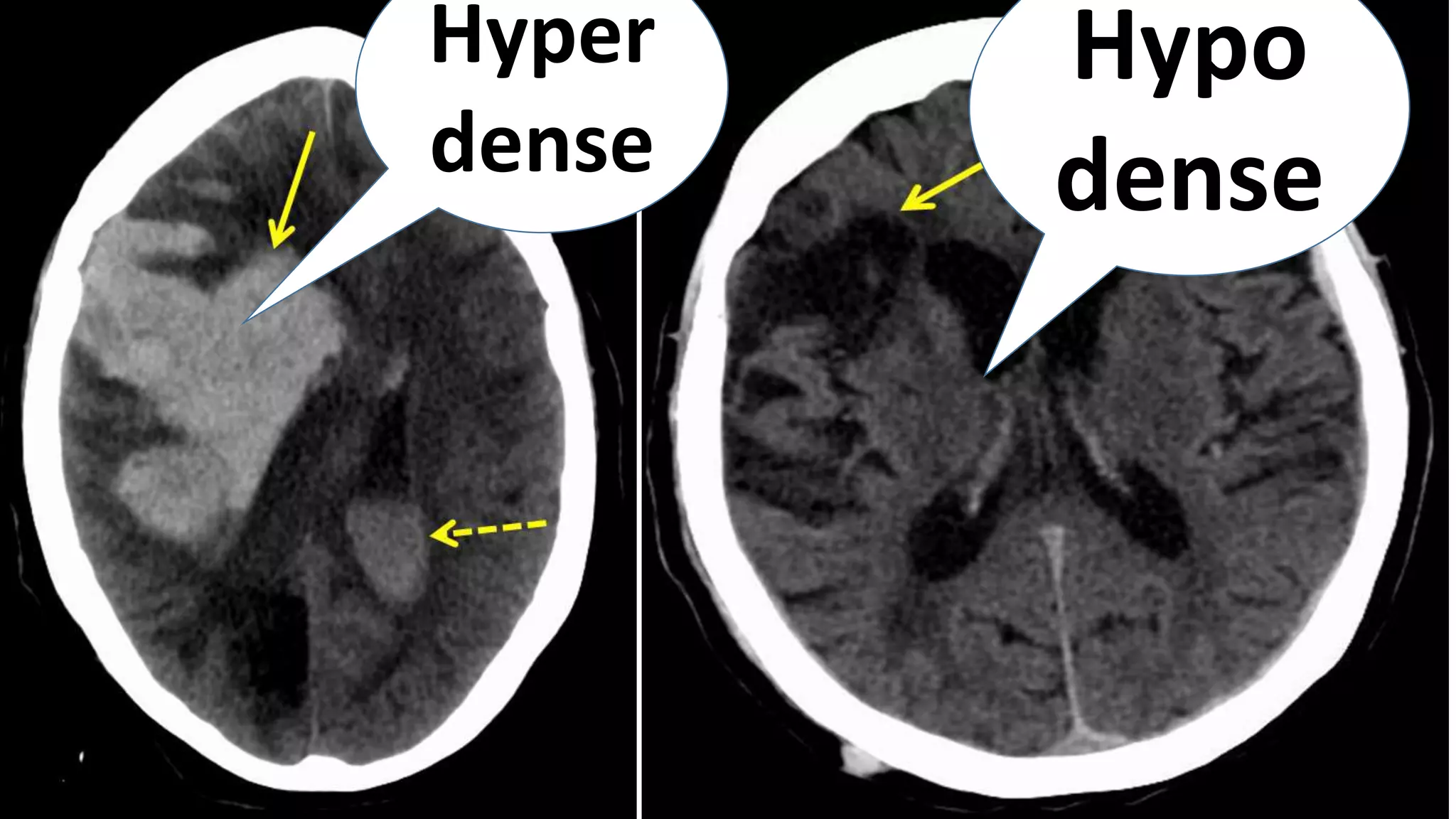 Abdominal CT scan, Triphasic CT scan, Abdominal Anatomy and ...
