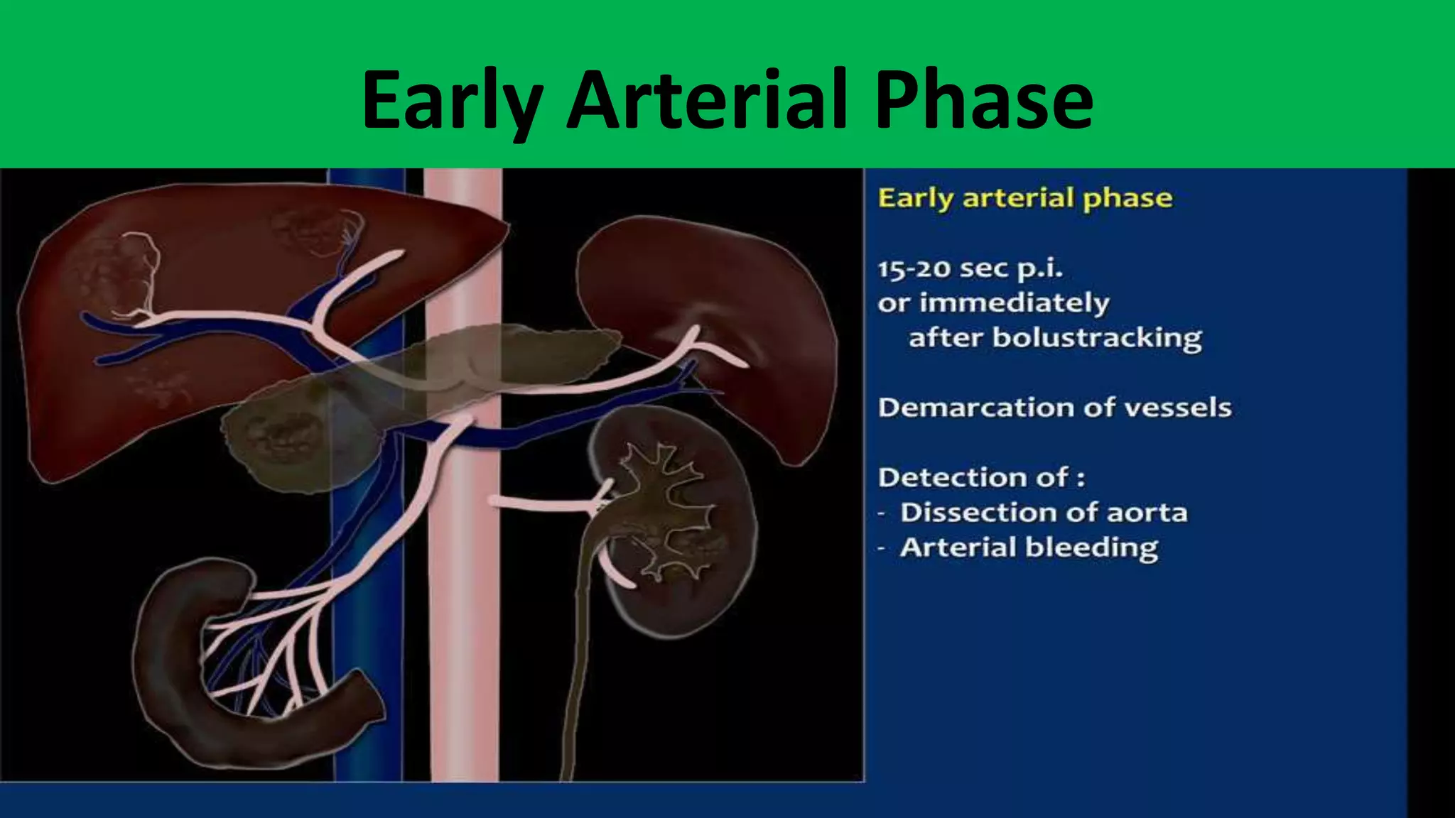 Abdominal CT scan, Triphasic CT scan, Abdominal Anatomy and ...