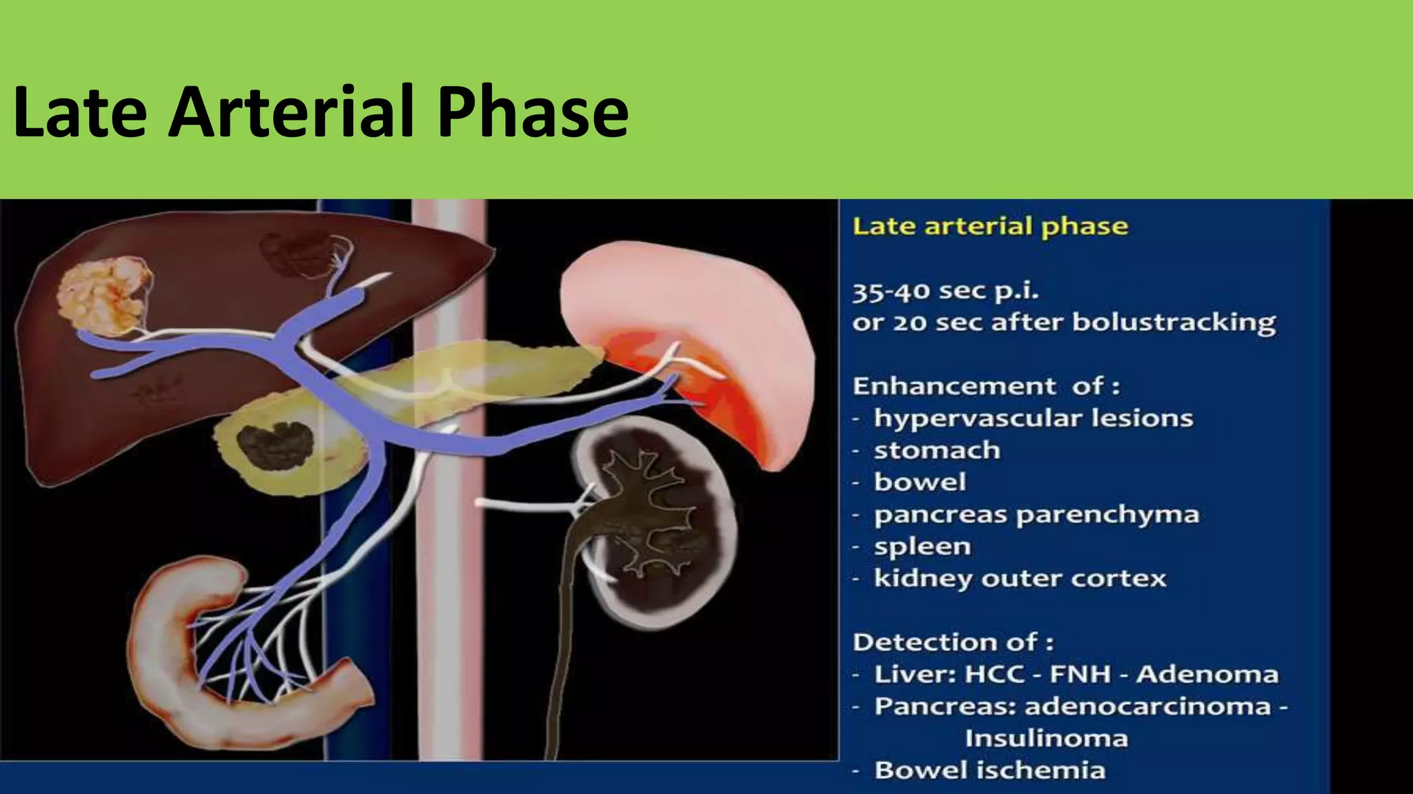 Abdominal CT scan, Triphasic CT scan, Abdominal Anatomy and ...
