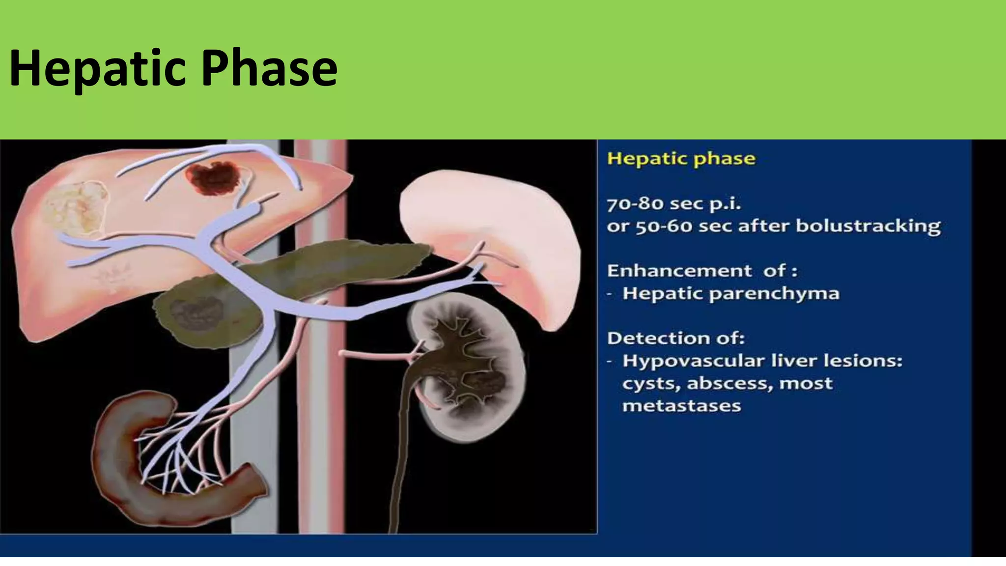 Abdominal CT scan, Triphasic CT scan, Abdominal Anatomy and ...