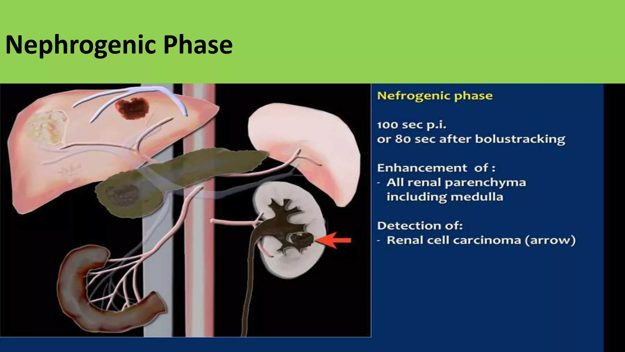 Abdominal CT scan, Triphasic CT scan, Abdominal Anatomy and ...