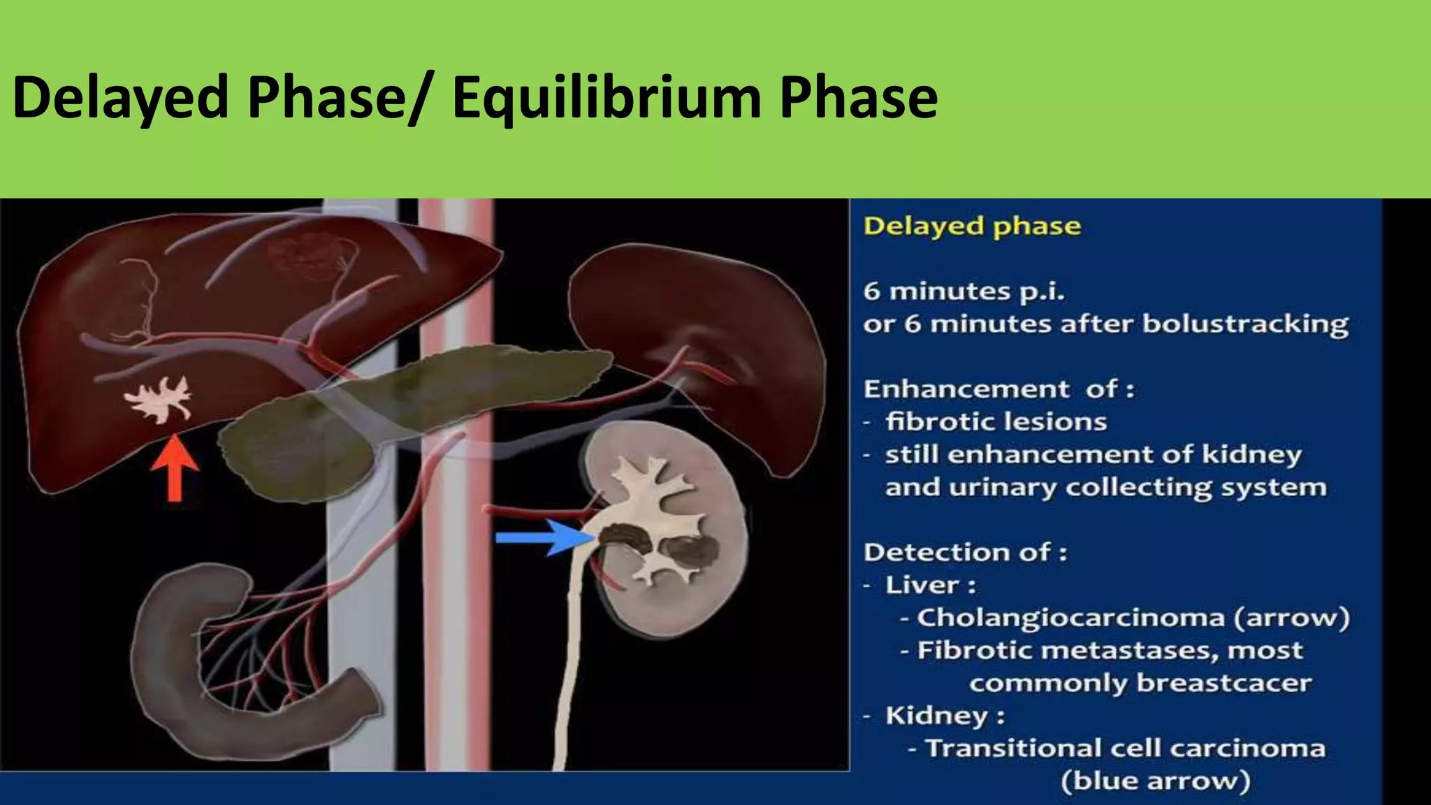 Abdominal CT scan, Triphasic CT scan, Abdominal Anatomy and ...