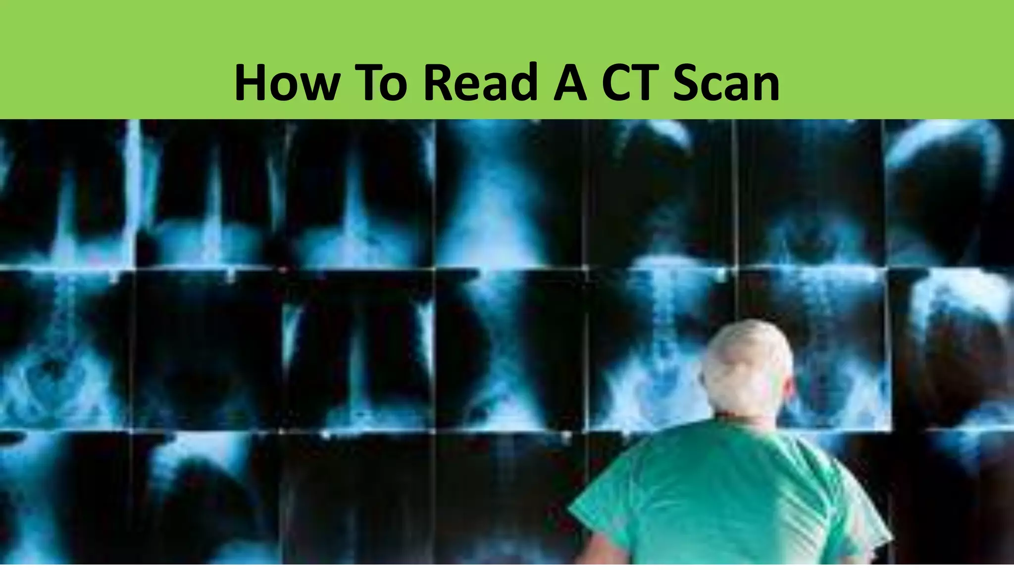 Abdominal CT scan, Triphasic CT scan, Abdominal Anatomy and ...