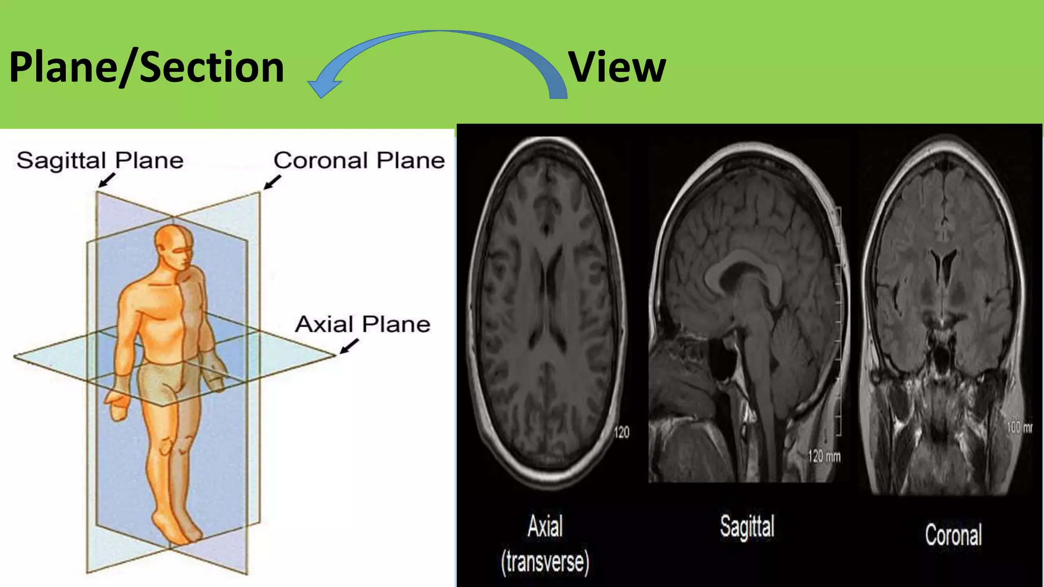 Abdominal CT scan, Triphasic CT scan, Abdominal Anatomy and ...