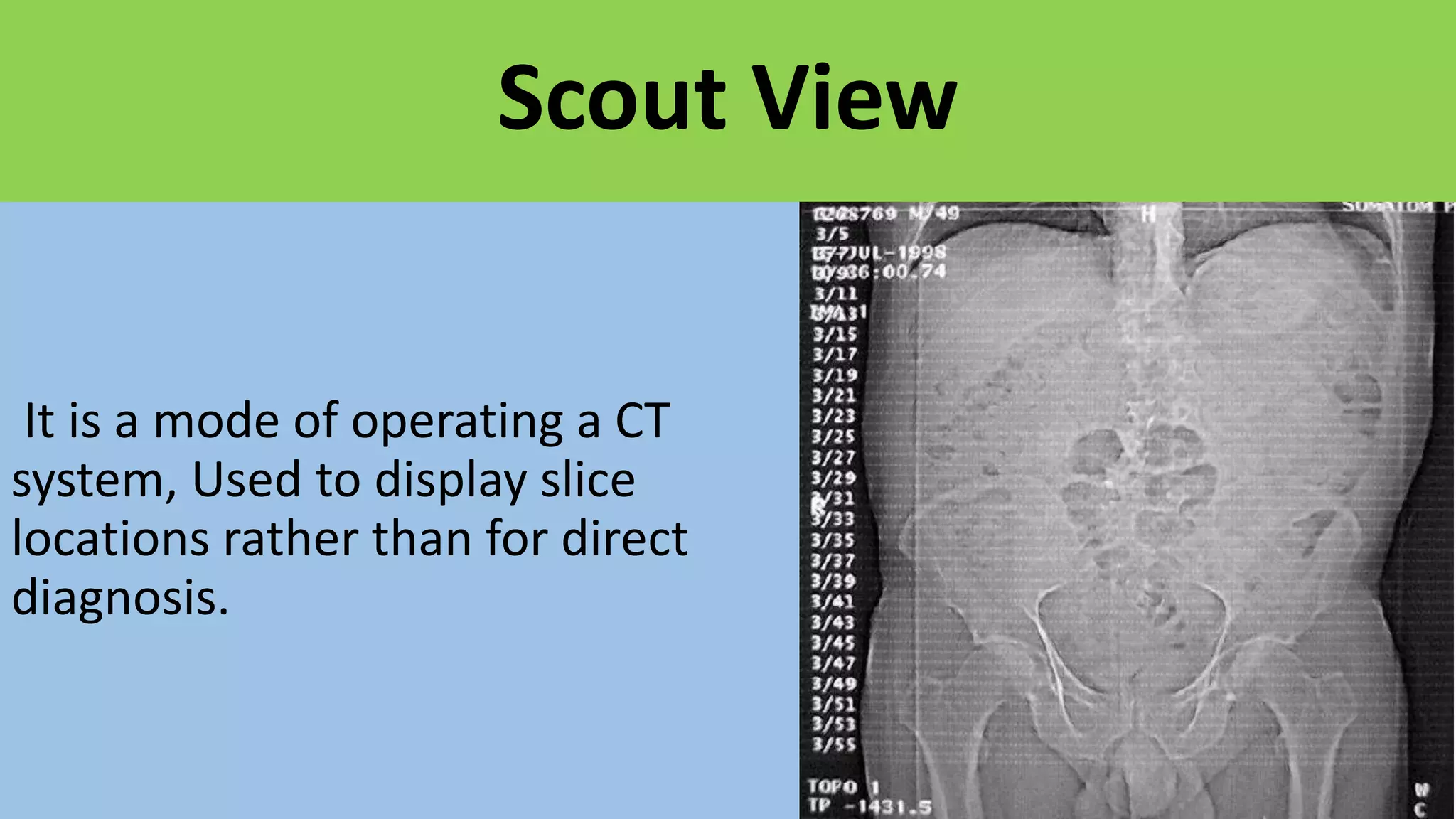 Abdominal CT scan, Triphasic CT scan, Abdominal Anatomy and ...