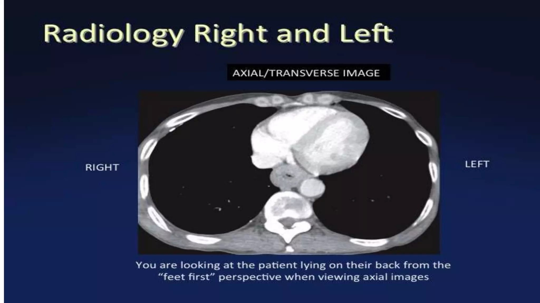 Abdominal CT scan, Triphasic CT scan, Abdominal Anatomy and ...