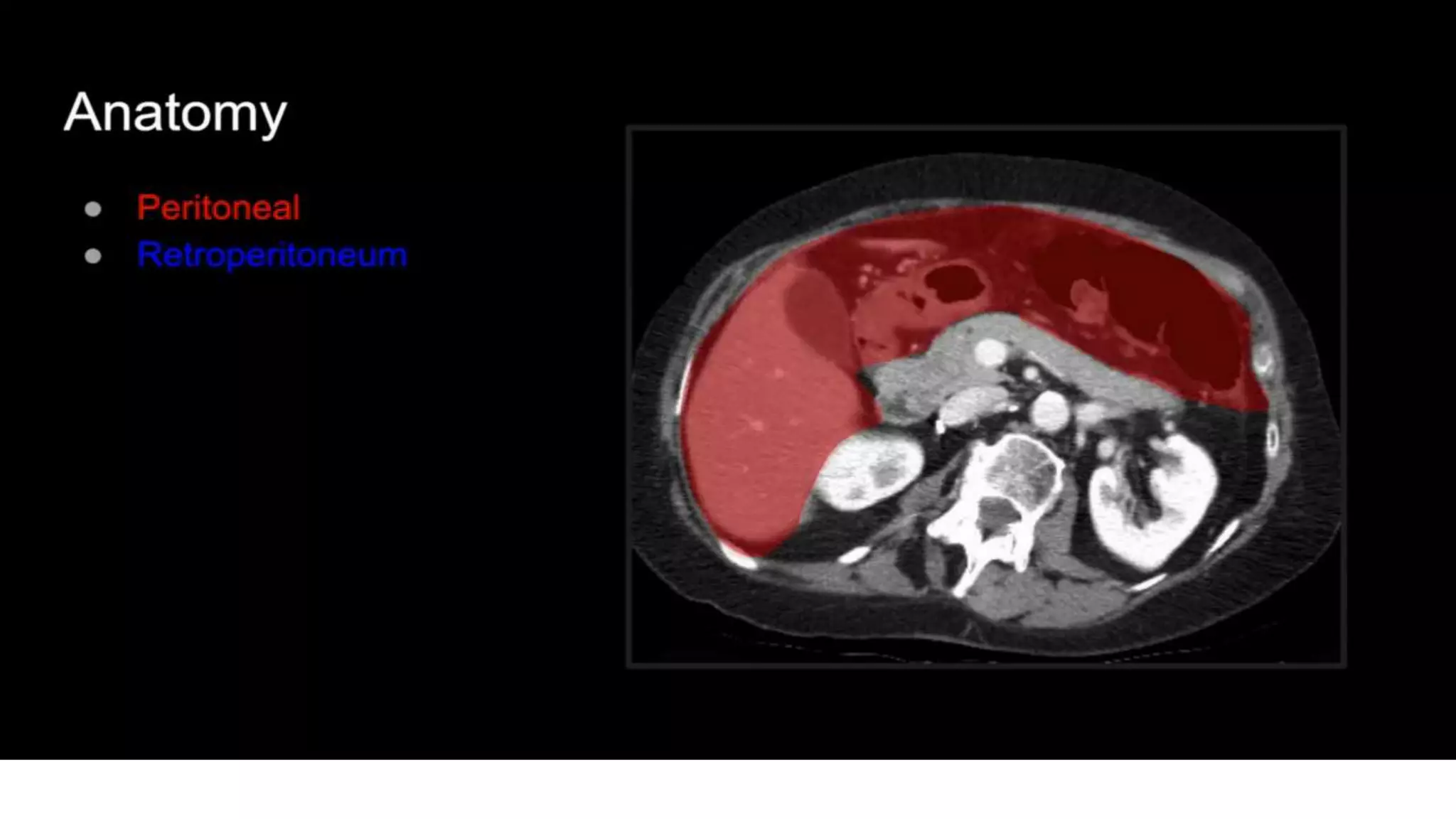 Abdominal CT scan, Triphasic CT scan, Abdominal Anatomy and Hepatobiliary pathology | PPTX