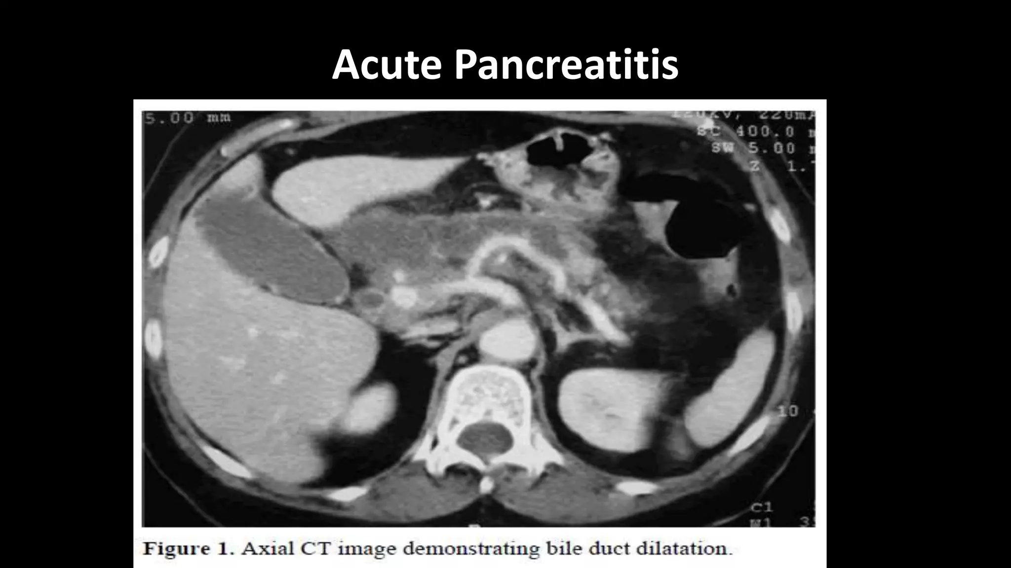 Abdominal CT scan, Triphasic CT scan, Abdominal Anatomy and ...